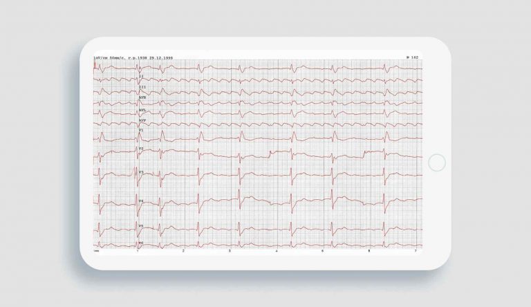 Computer Vision System for ECG | Computer Vision in Medical Imaging ...